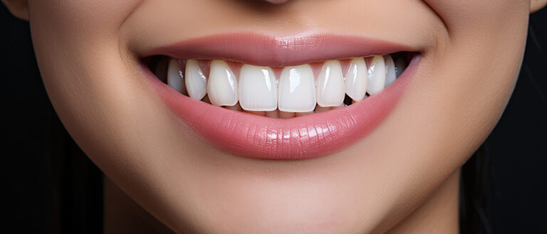 Enhance Your Smile with Front Teeth Veneers | Trillium Smile Dentistry